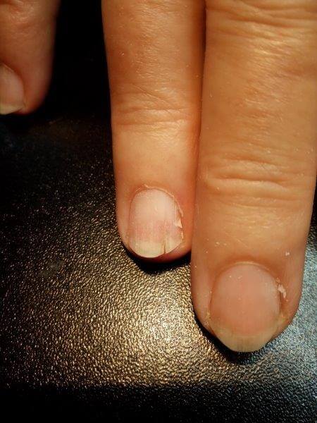 Last van beschadigde nagels? 5 tips om je nagels te (laten) herstellen ...